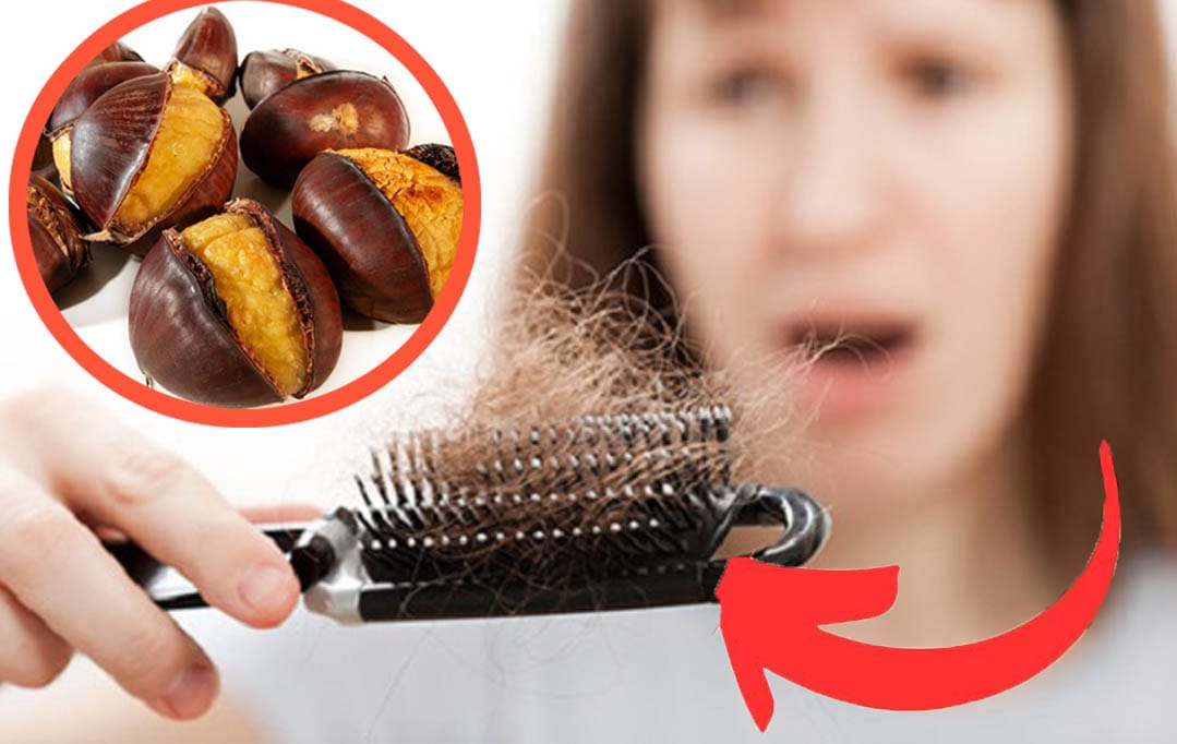 Periodo delle castagne, "mi cadono i capelli": come mai? Niente panico ...